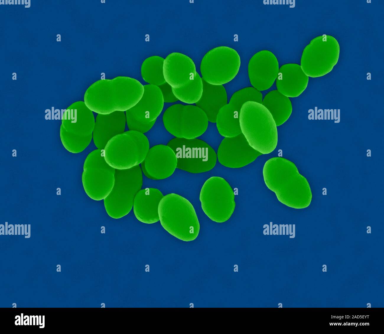 Coloured scanning electron micrograph (SEM) of Streptococcus pneumoniae ...