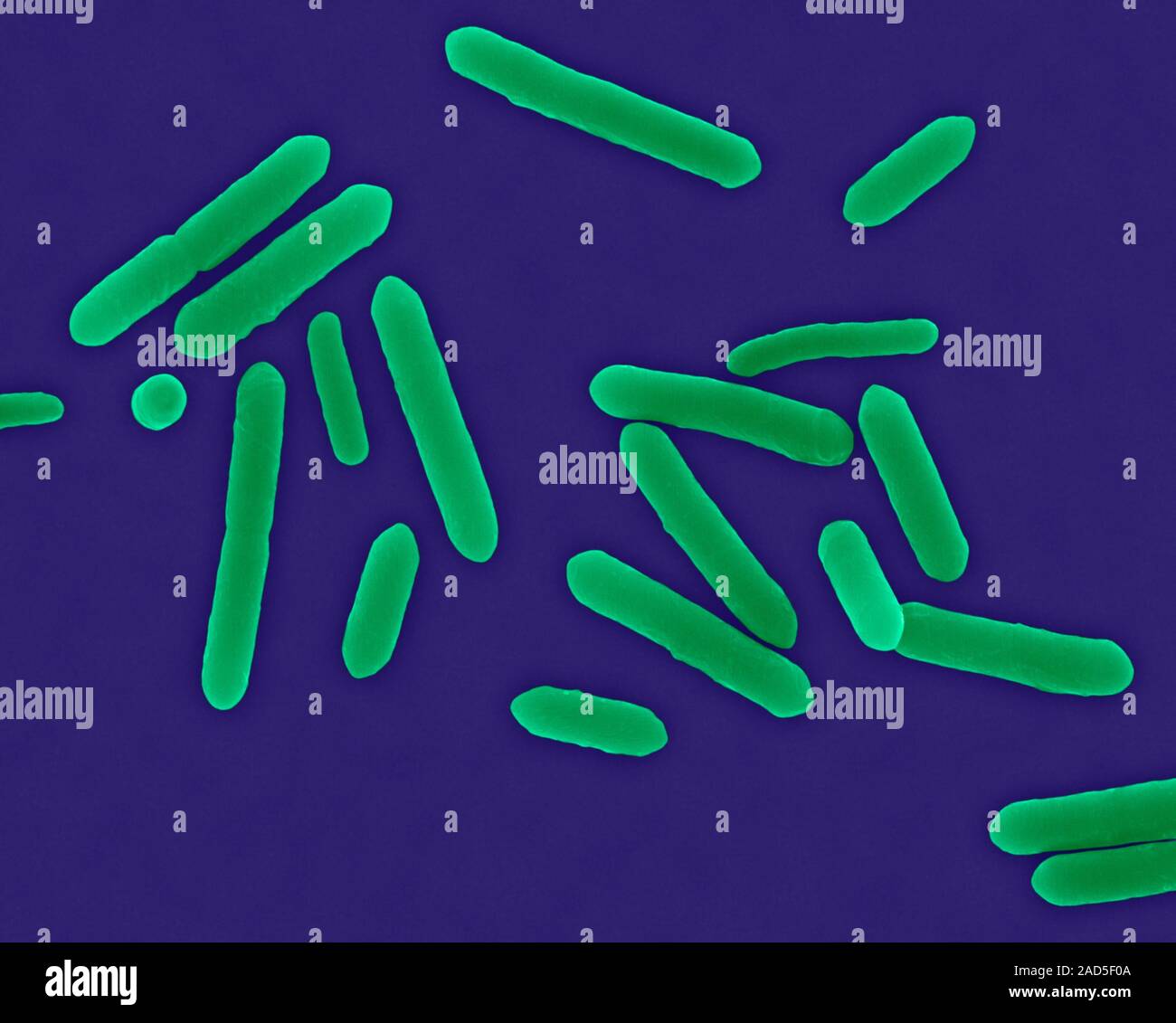 Coloured scanning electron micrograph (SEM) of Clostridium tetani ...