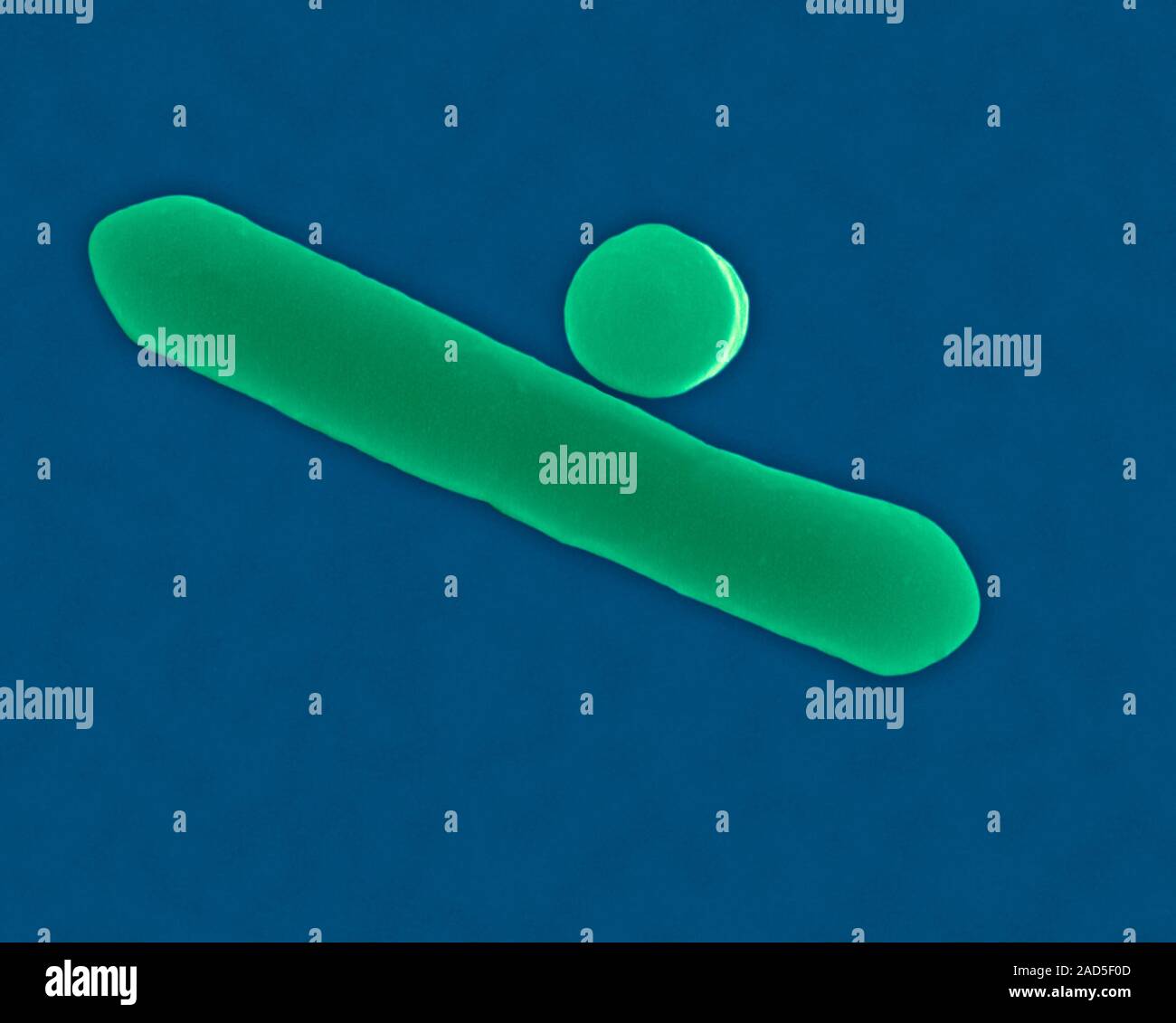 Coloured scanning electron micrograph (SEM) of Clostridium botulinum ...