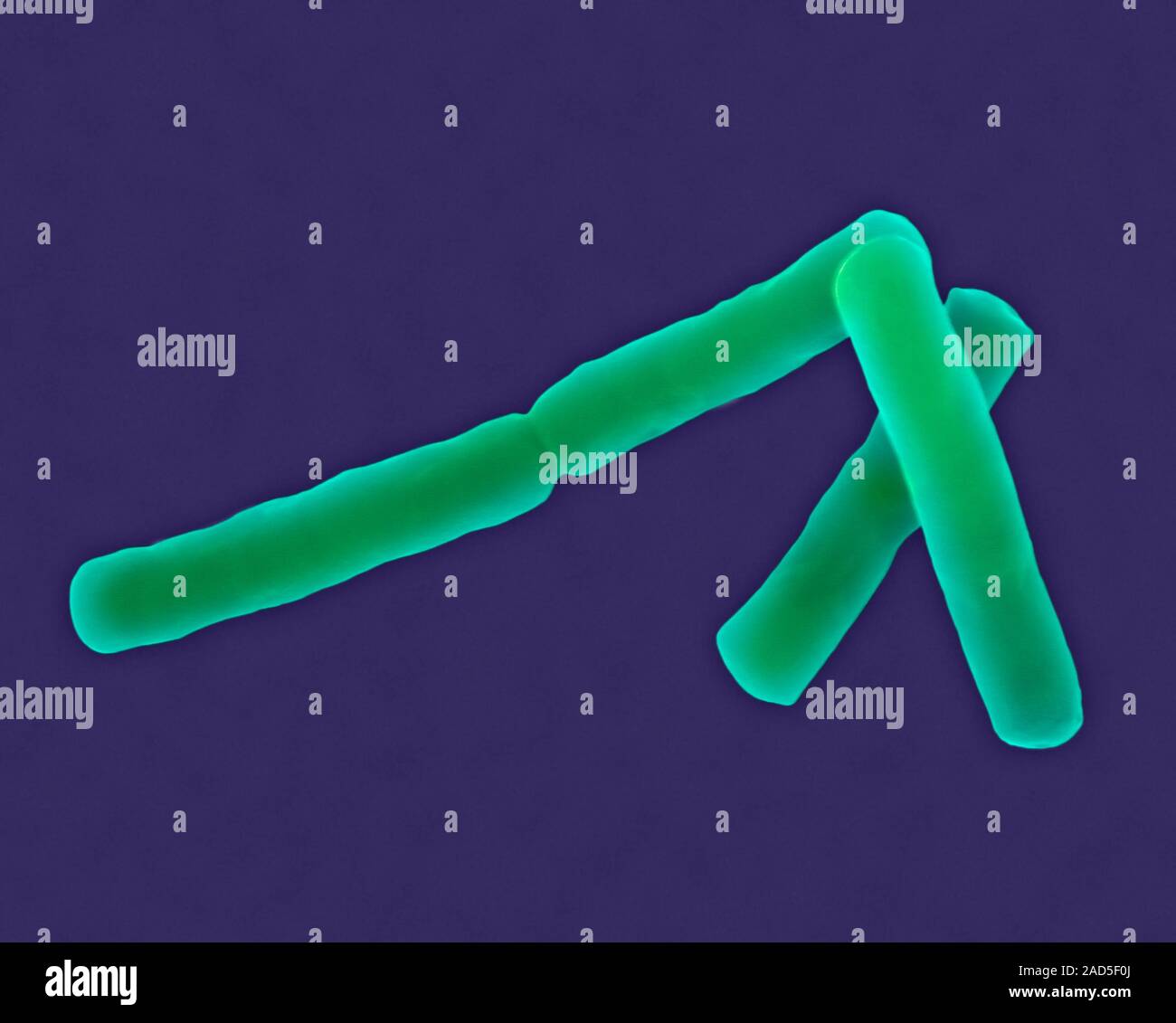 Coloured scanning electron micrograph (SEM) of Bacillus cereus , Gram ...