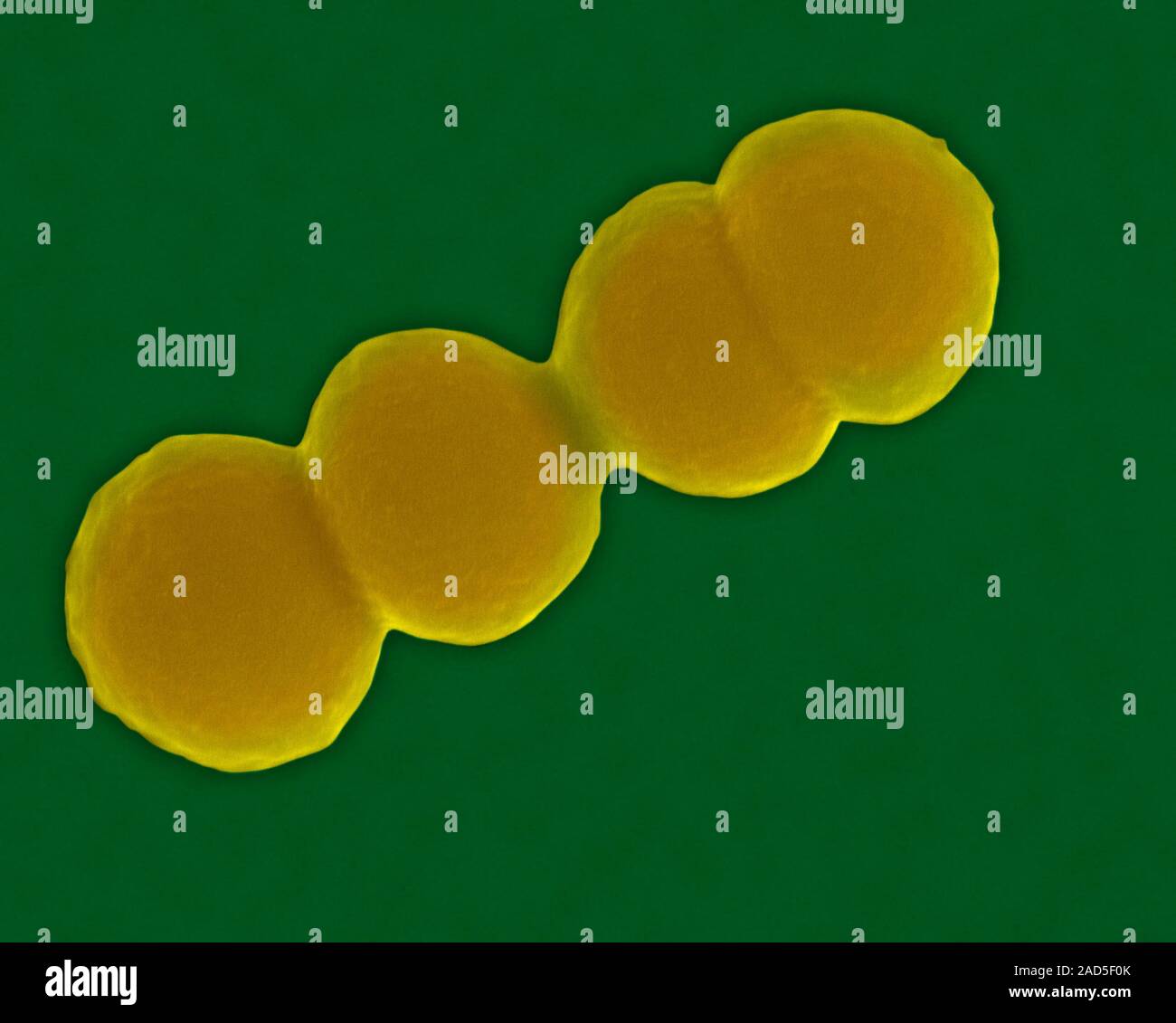Coloured scanning electron micrograph (SEM) of Streptococcus pyogenes ...