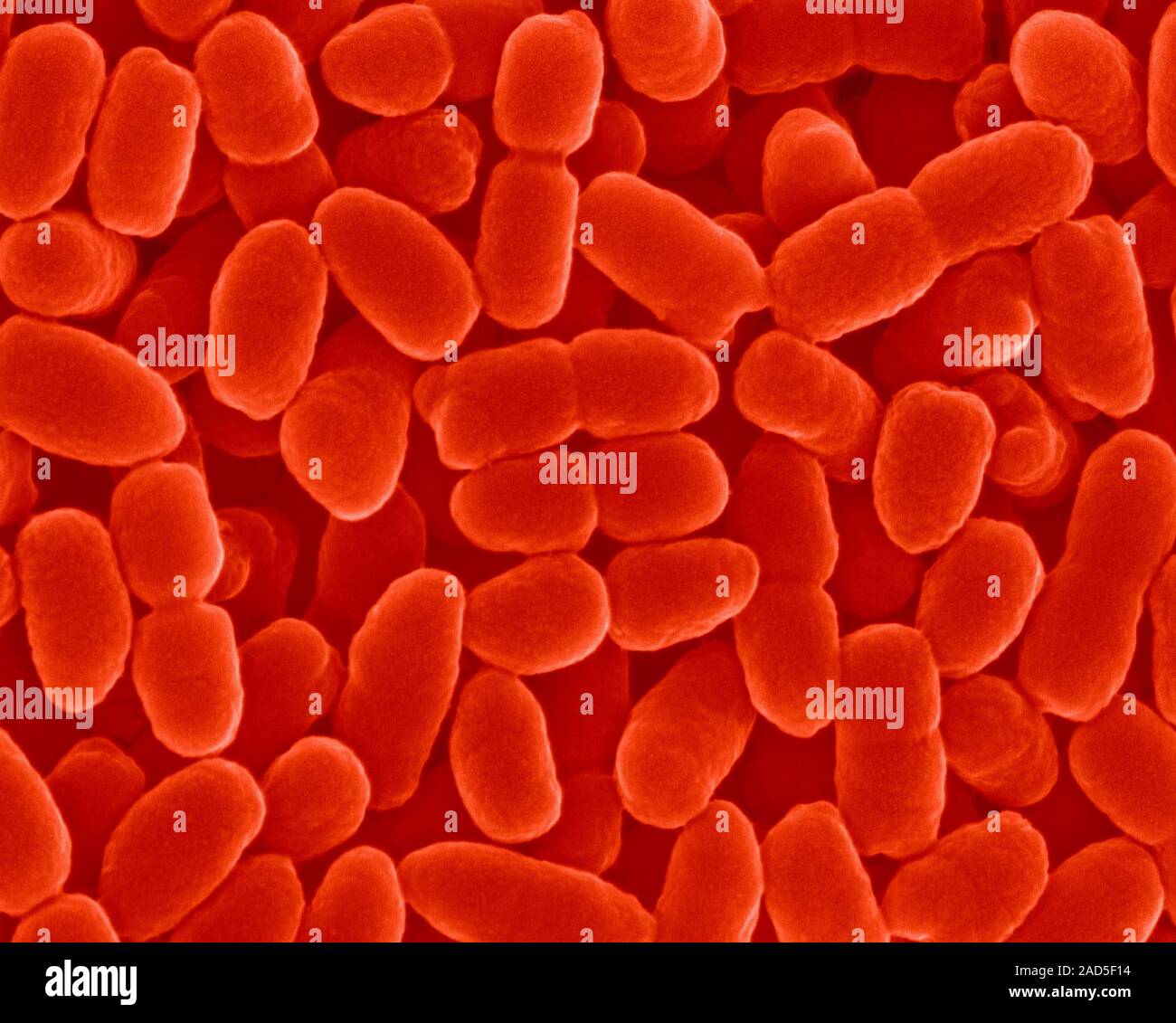 Coloured scanning electron micrograph (SEM) of Bordetella holmesii ...