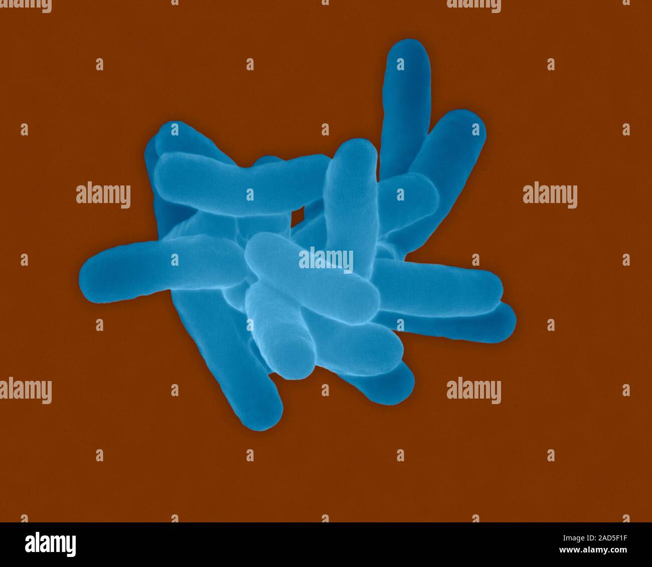 Coloured scanning electron micrograph (SEM) of Tatlockia micdadei, rod ...