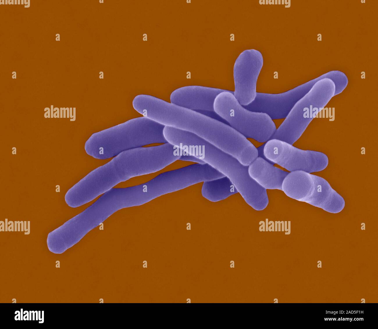 Coloured scanning electron micrograph (SEM) of Rhodococcus fascians ...