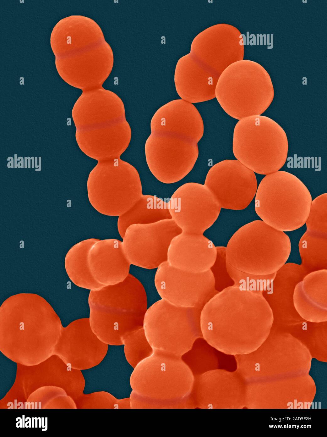 Coloured scanning electron micrograph (SEM) of Staphylococcus ...