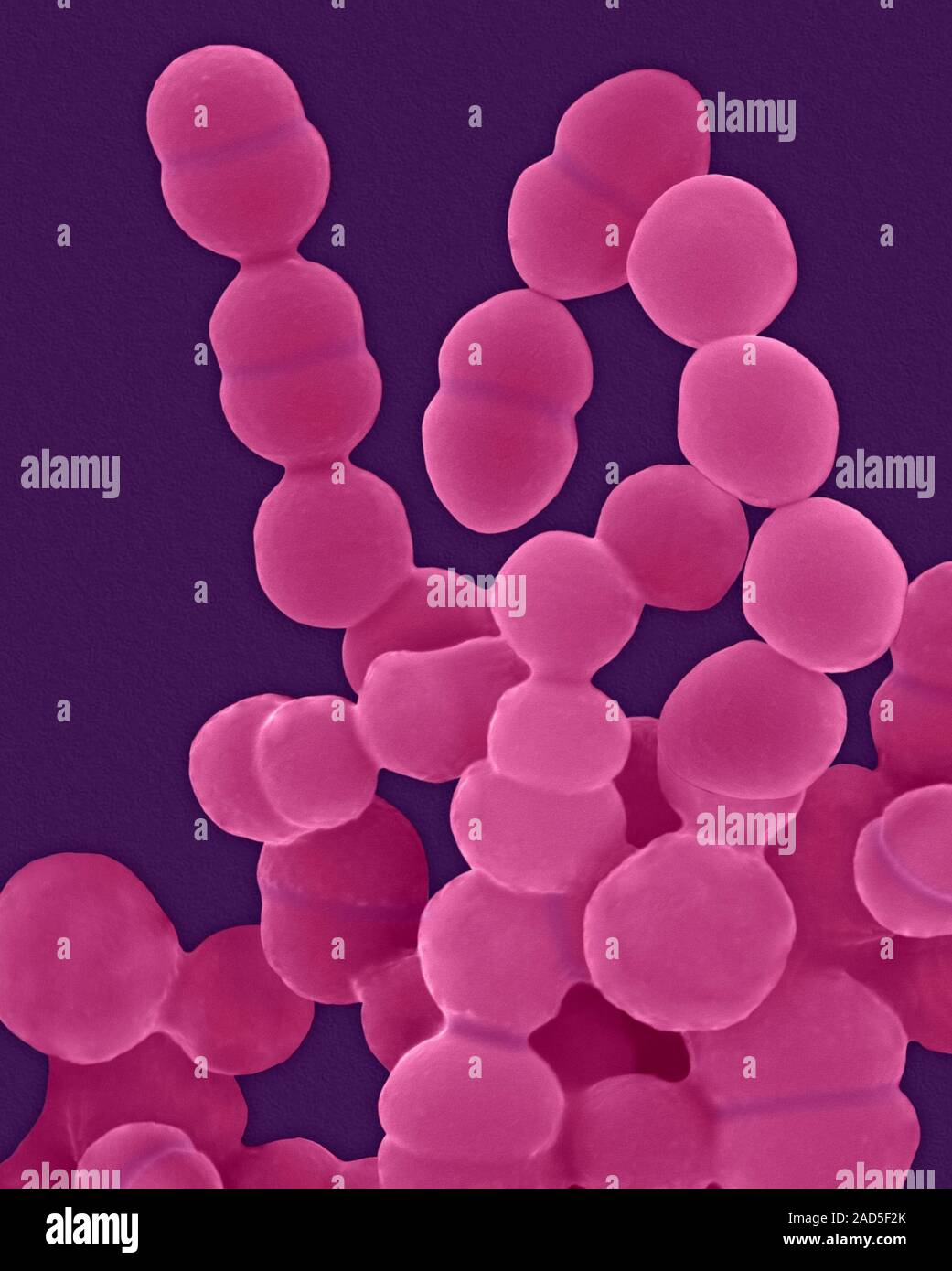 Coloured scanning electron micrograph (SEM) of Staphylococcus ...