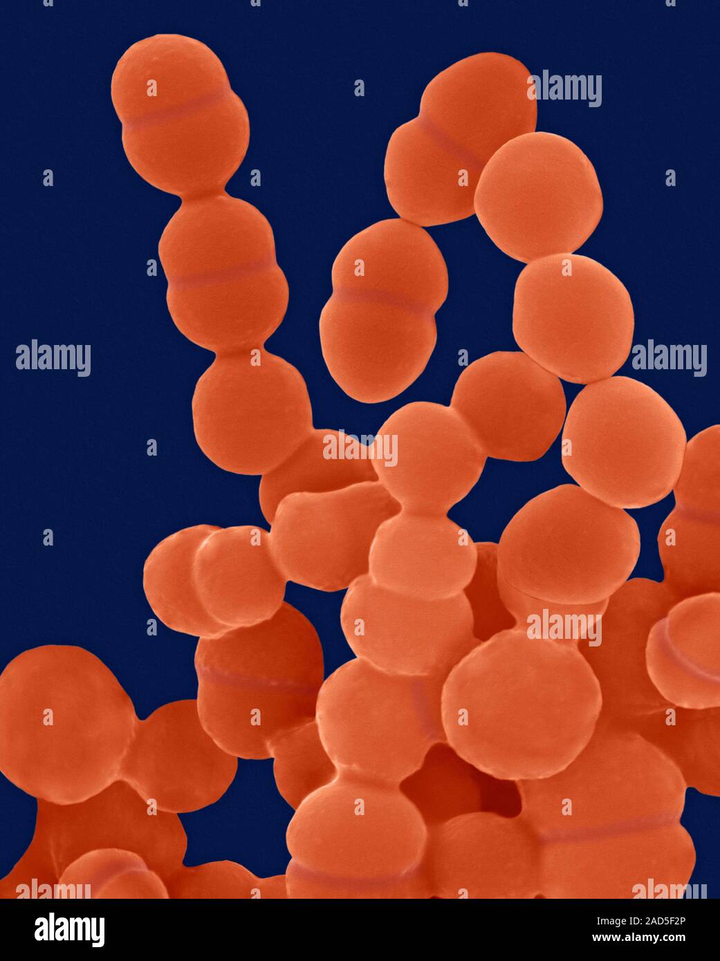 Coloured scanning electron micrograph (SEM) of Staphylococcus ...