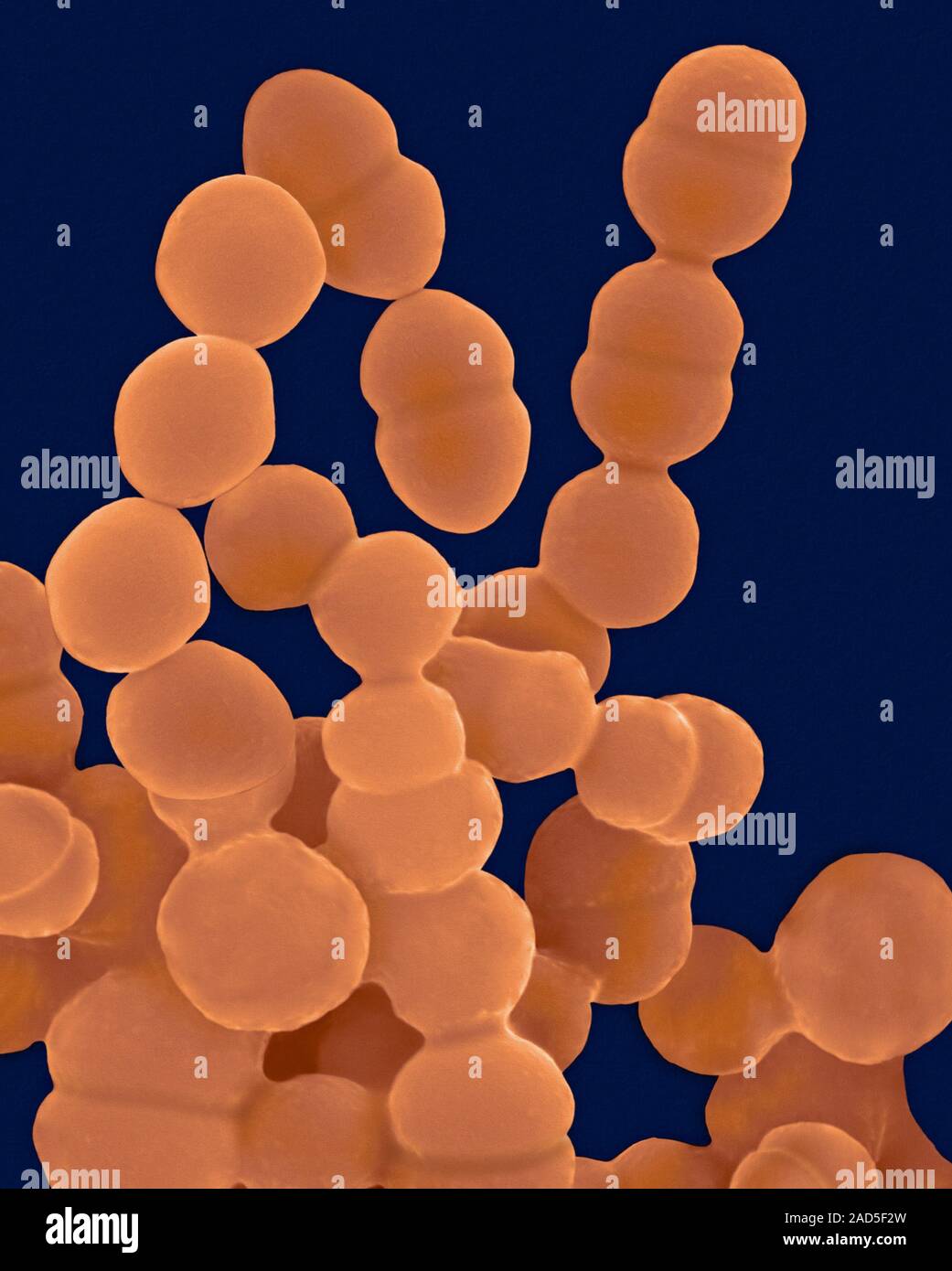 Coloured scanning electron micrograph (SEM) of Staphylococcus ...