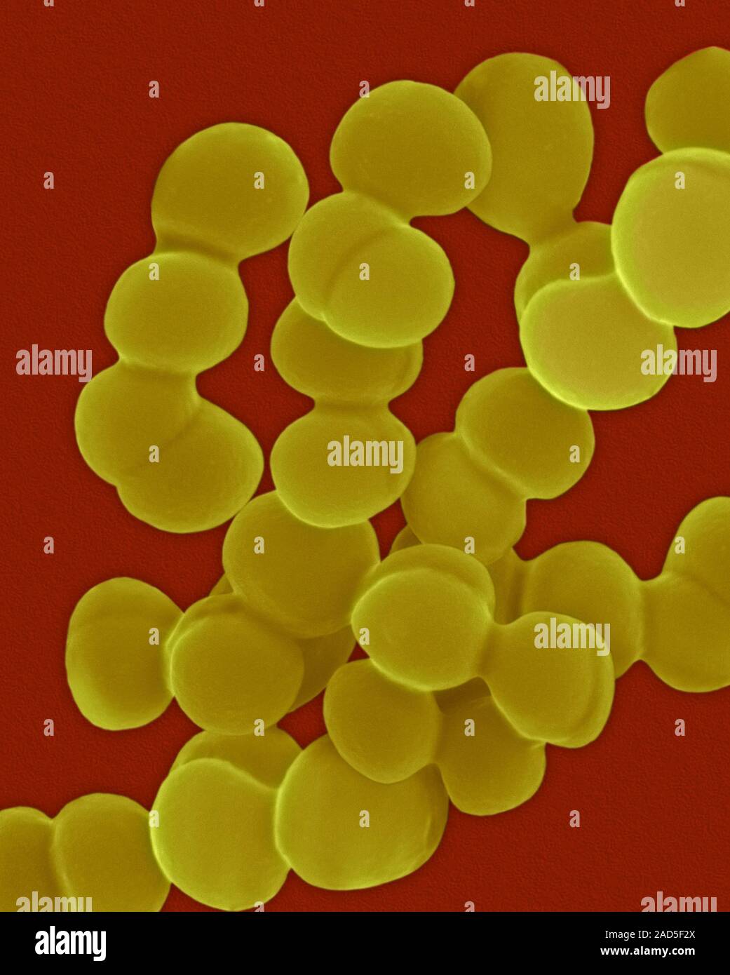 Coloured scanning electron micrograph (SEM) of Streptococcus viridans ...