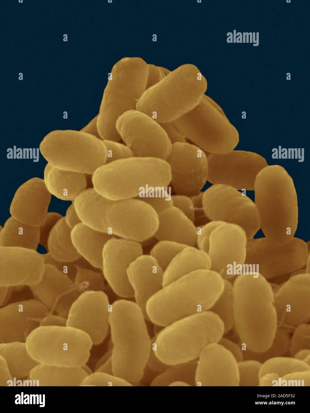 Coloured scanning electron micrograph (SEM) of Bordetella pertussis, Gram-negative, aerobic, non ...