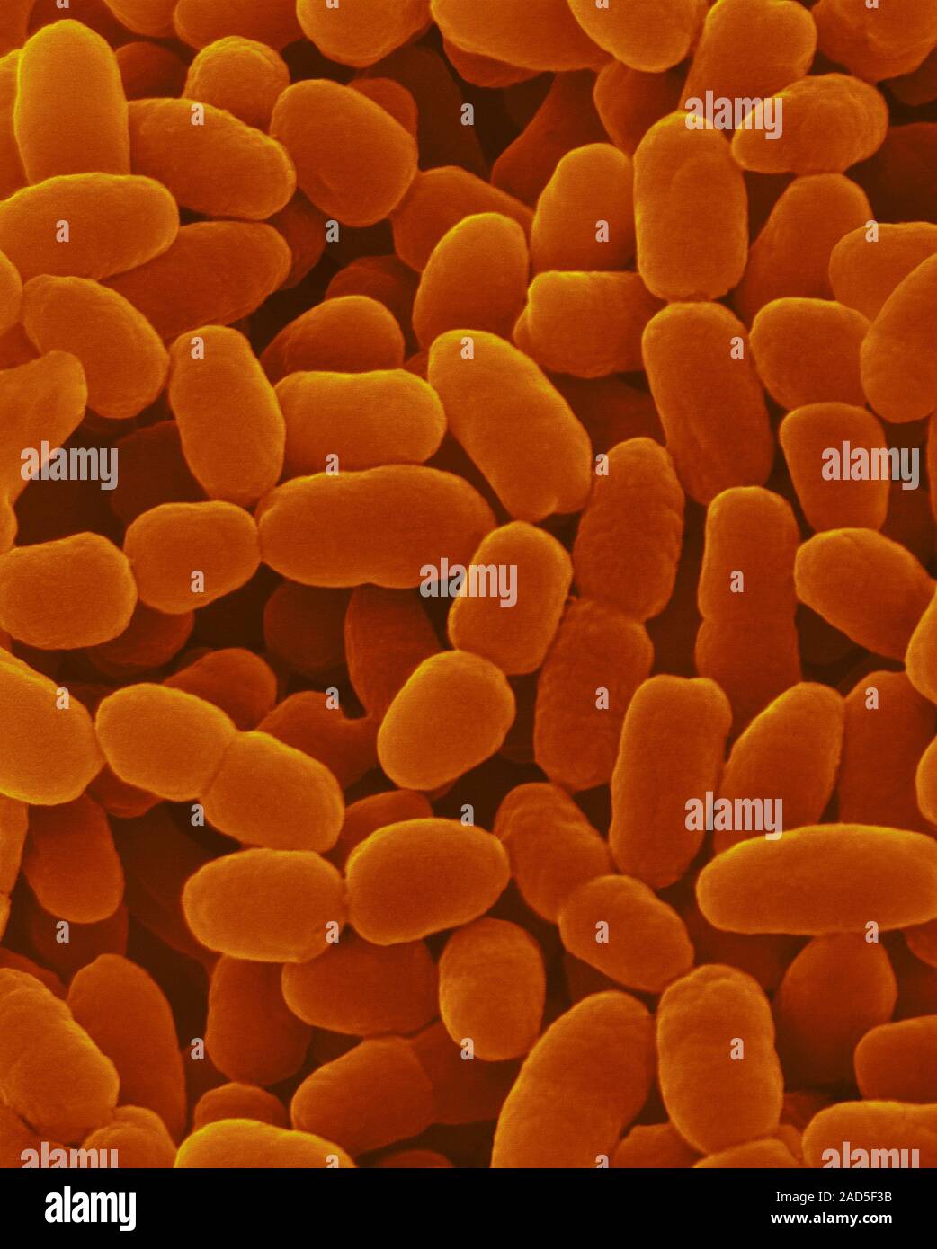 Coloured scanning electron micrograph (SEM) of Bordetella ...