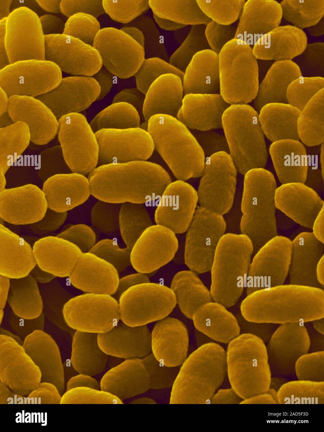 Coloured scanning electron micrograph (SEM) of Bordetella bronchiseptica, Gram-negative, aerobic ...