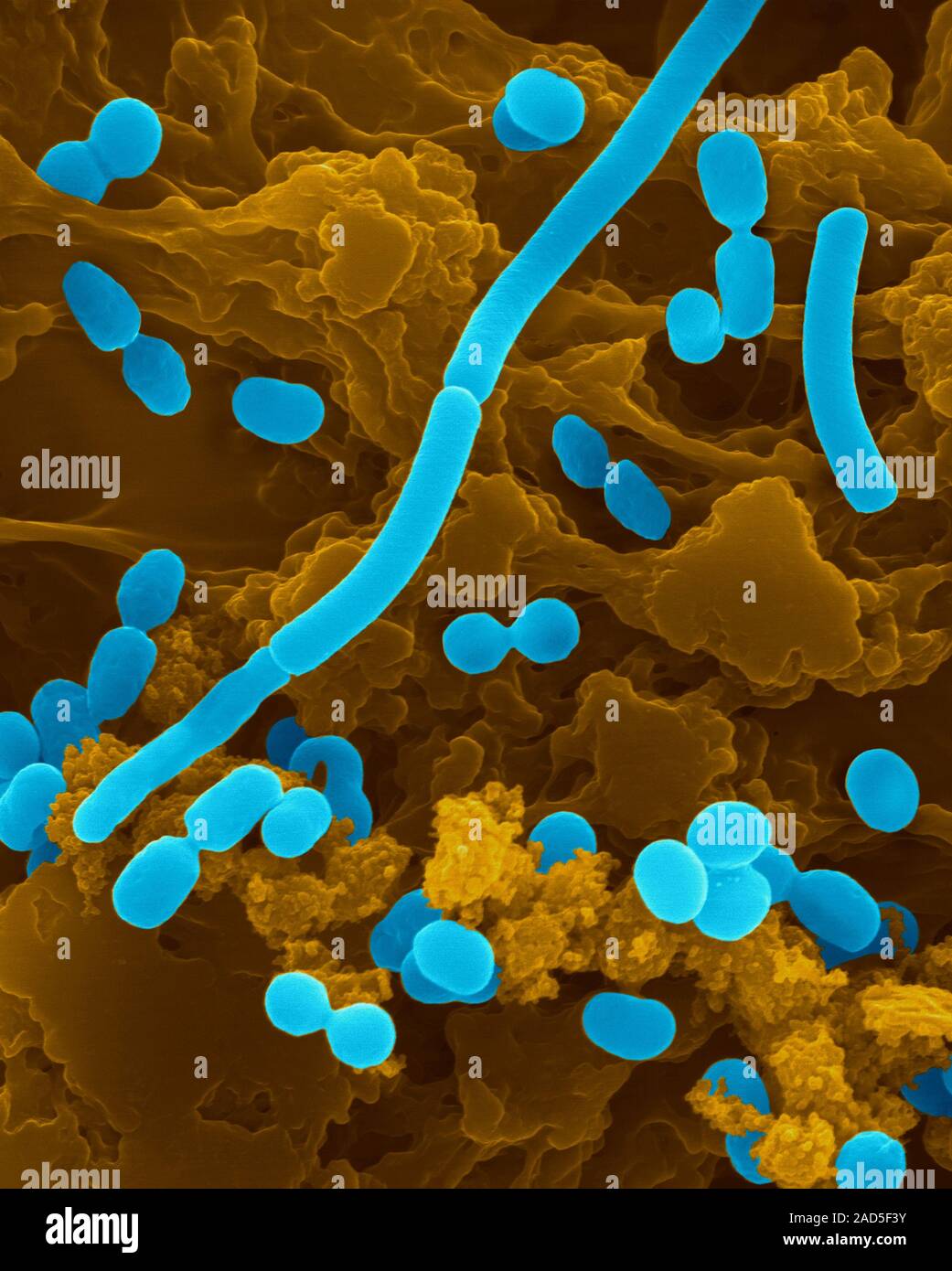 Coloured scanning electron micrograph (SEM) of Acinetobacter sp., gram ...