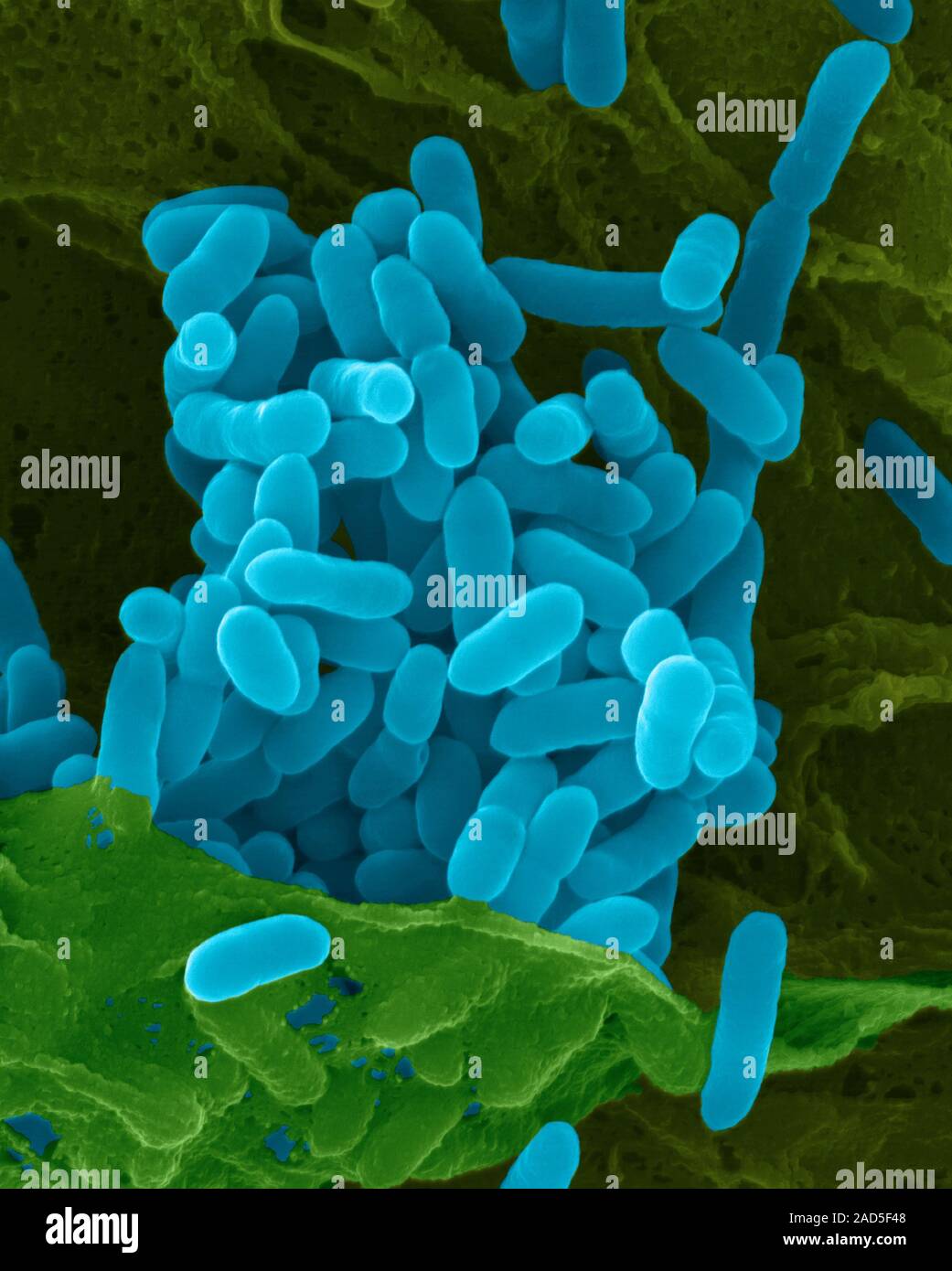Coloured scanning electron micrograph (SEM) of Burkholderia ...