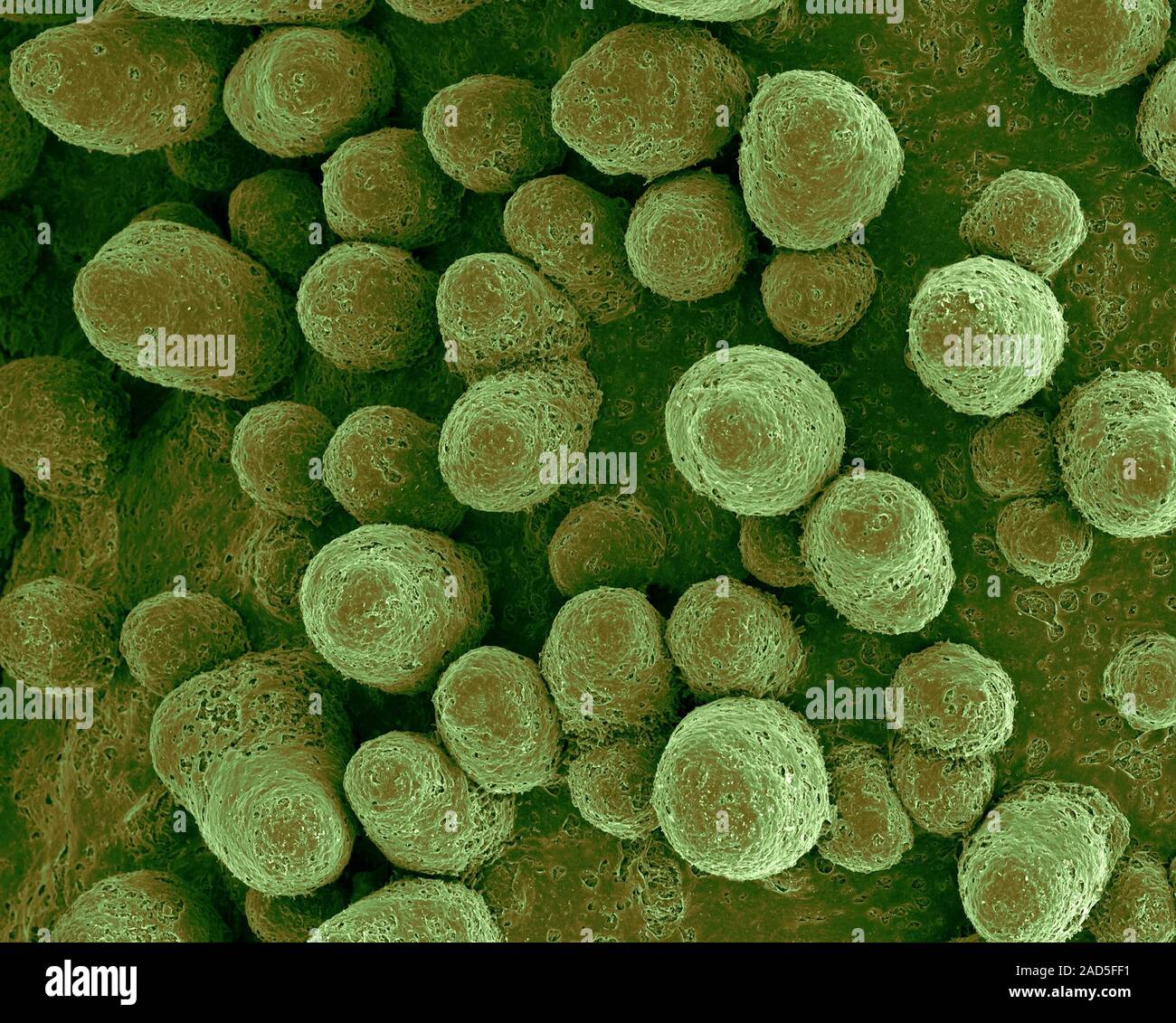 Coloured scanning electron micrograph (SEM) of Thallus of a crustose ...