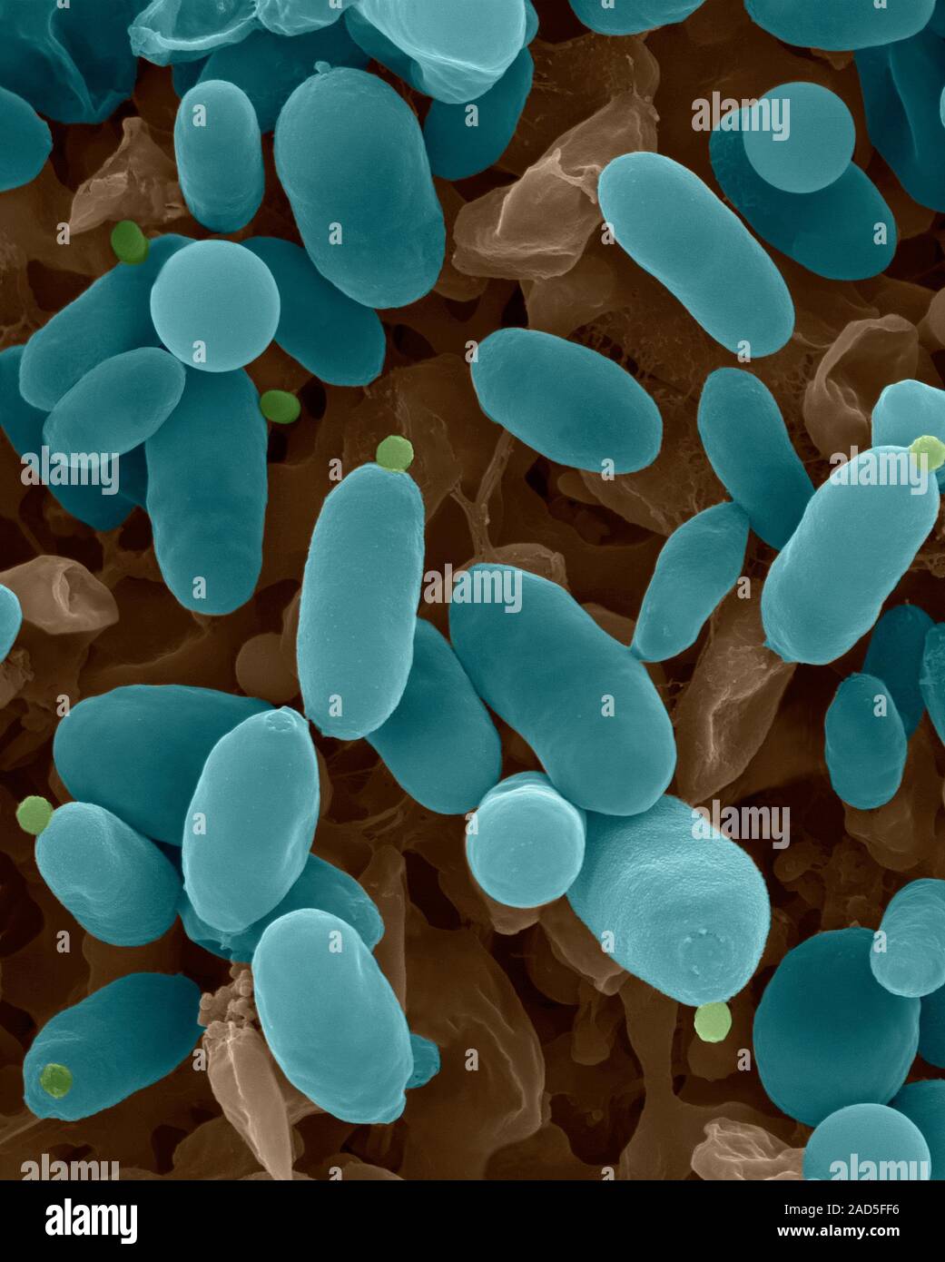 Coloured scanning electron micrograph (SEM) of Pigmented false yeast ...
