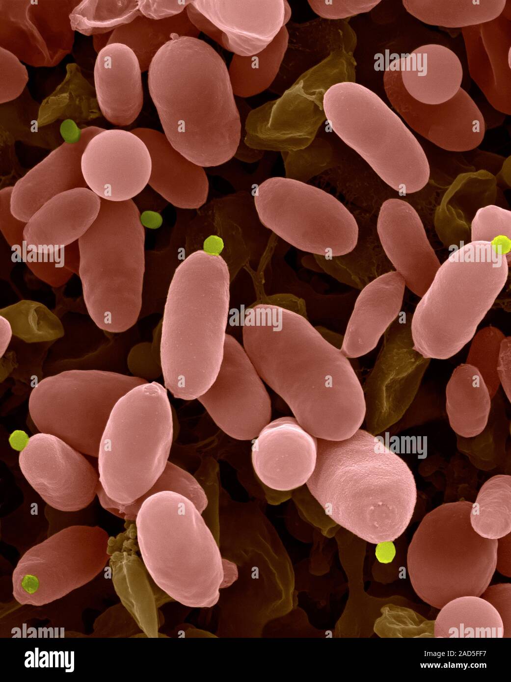 Coloured scanning electron micrograph (SEM) of Pigmented false yeast ...