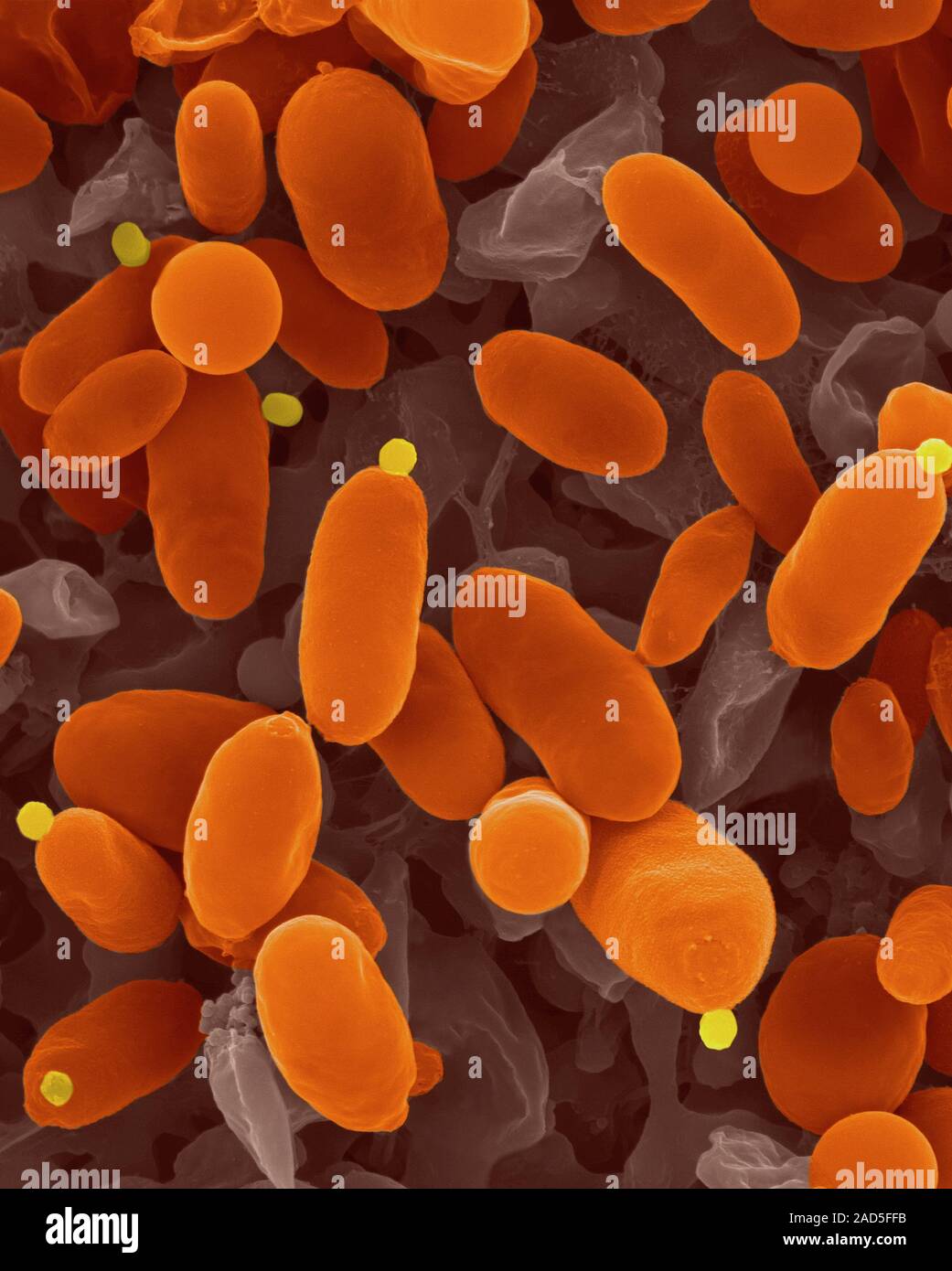 Coloured scanning electron micrograph (SEM) of Pigmented false yeast ...