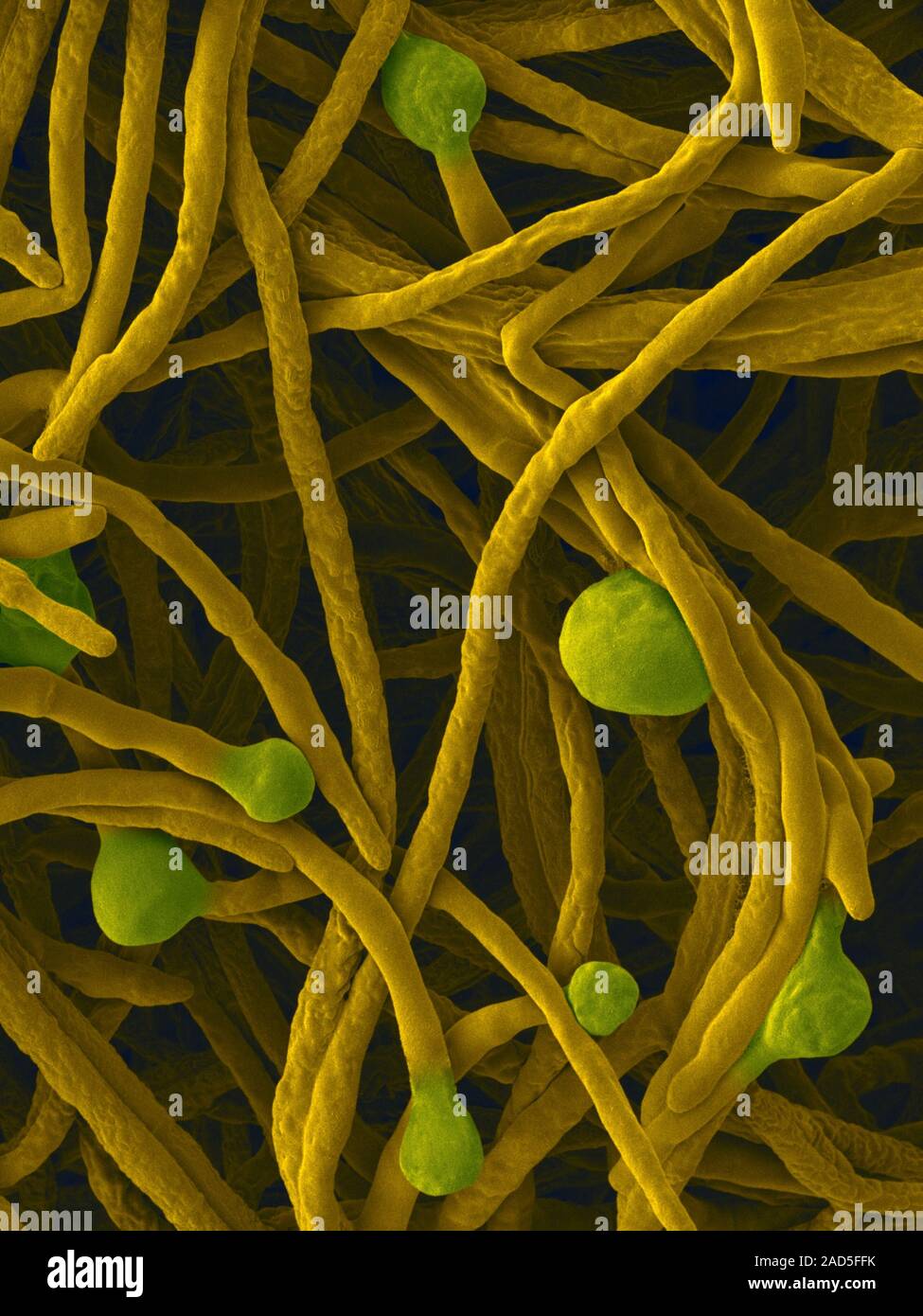 Coloured scanning electron micrograph (SEM) of Phaeosphaeria ...