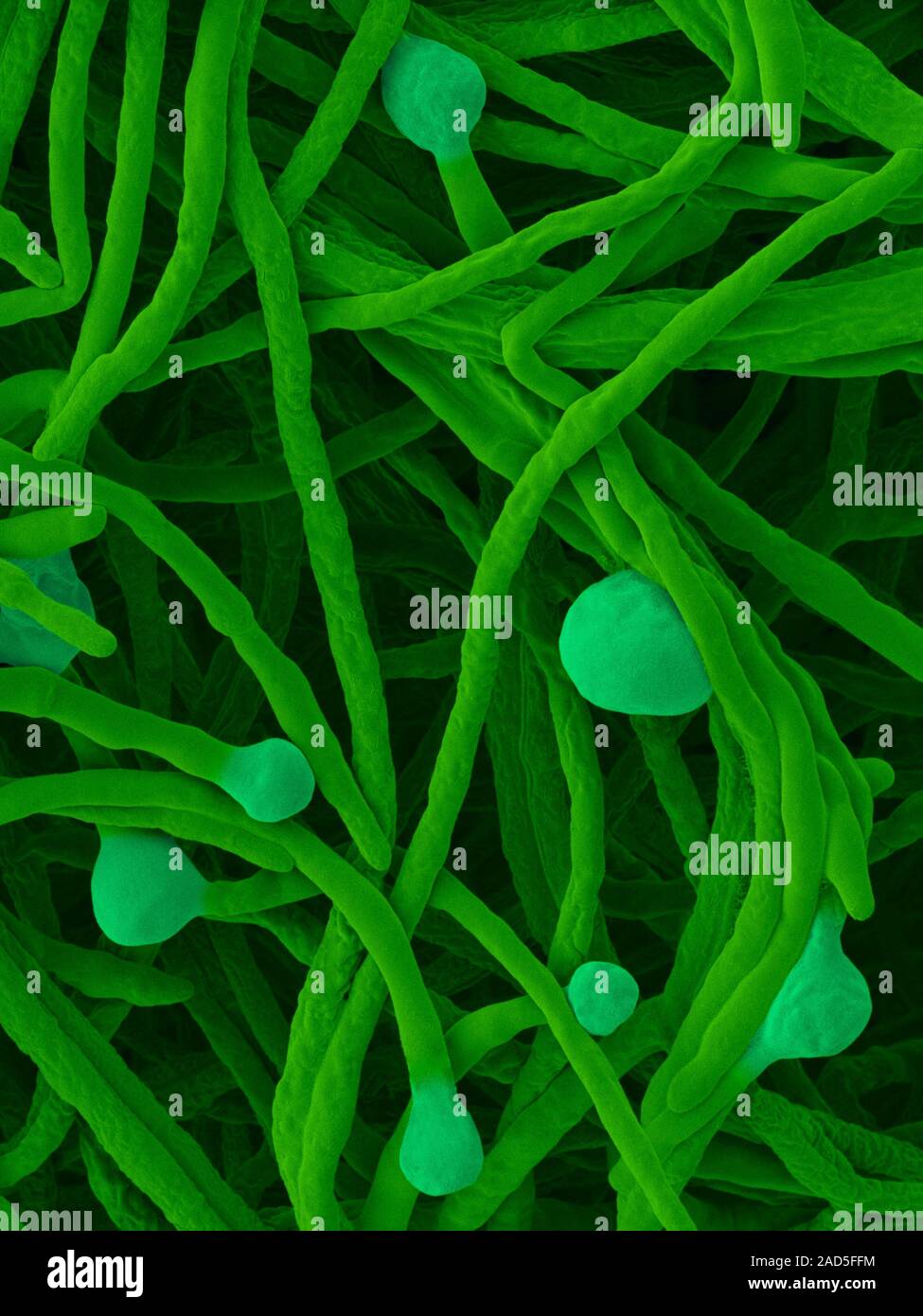 Coloured scanning electron micrograph (SEM) of Phaeosphaeria ...