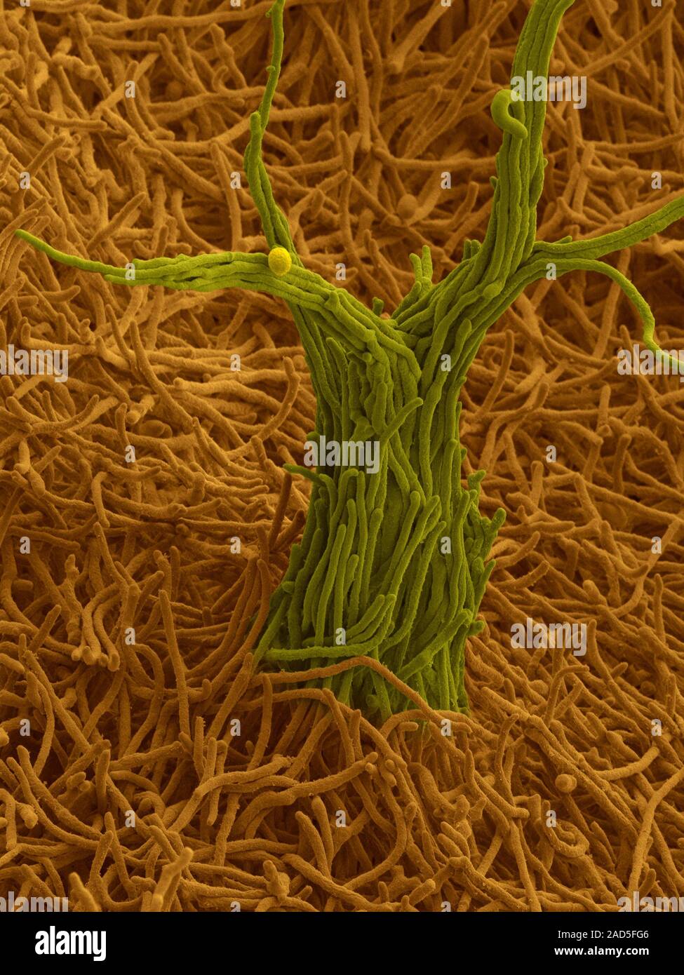 Coloured scanning electron micrograph (SEM) of Exophiala spinifera is a ...