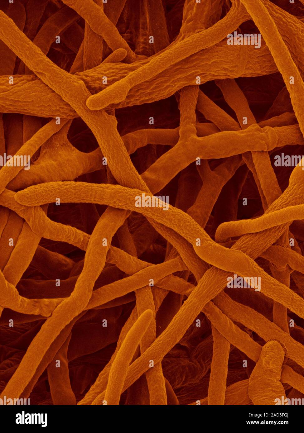 Coloured scanning electron micrograph (SEM) of Irpex lacteus is a ...
