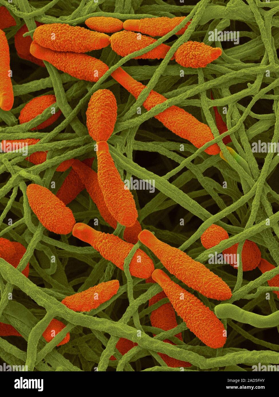 Coloured scanning electron micrograph (SEM) of the sporulating ...