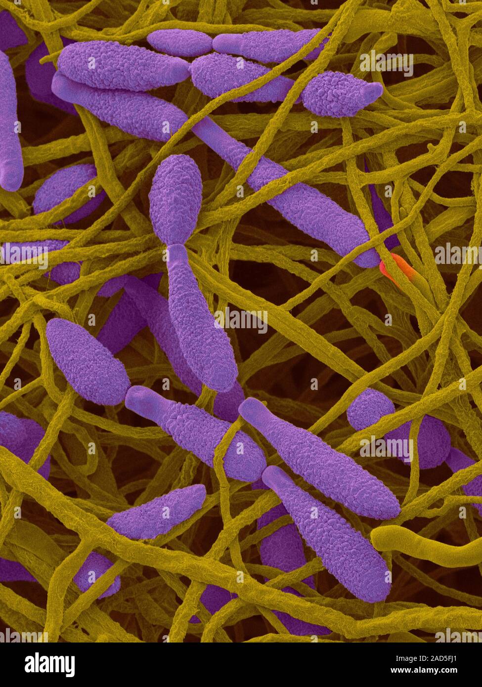 Coloured scanning electron micrograph (SEM) of the sporulating ...