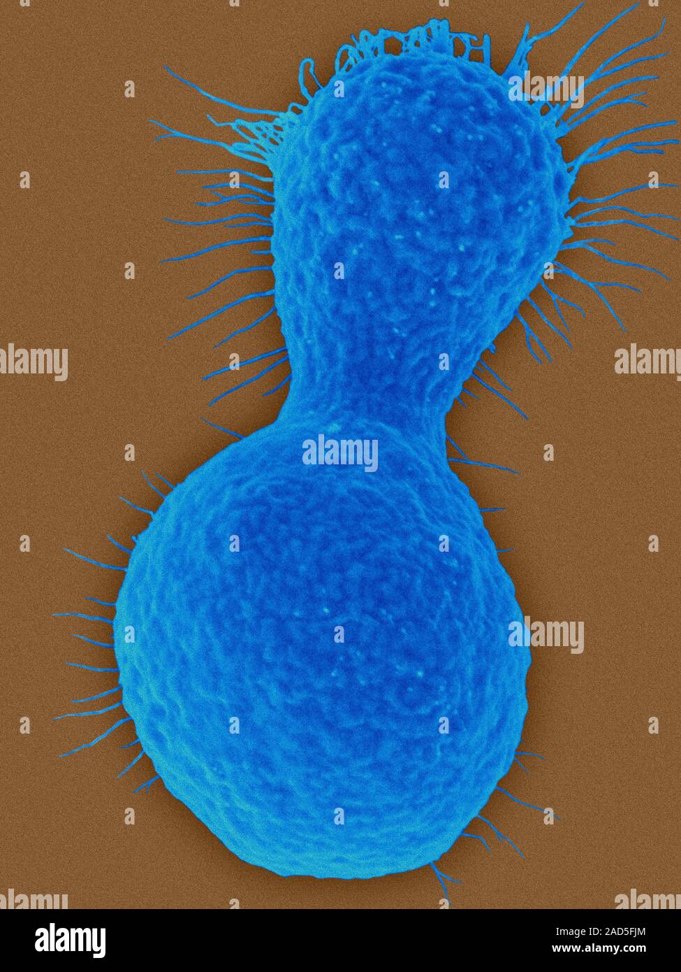 Coloured scanning electron micrograph (SEM) of Myxozyma mucilagina, an ...