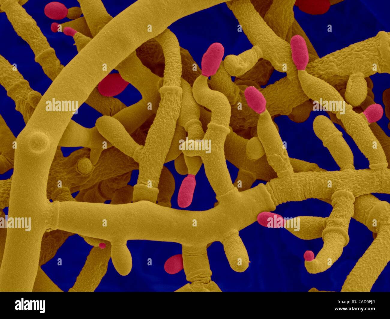 Coloured scanning electron micrograph (SEM) of Trichoderma ...
