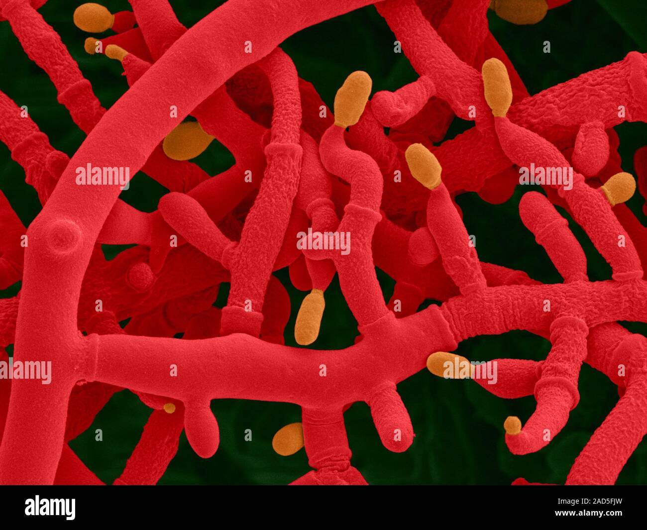 Coloured scanning electron micrograph (SEM) of Trichoderma ...