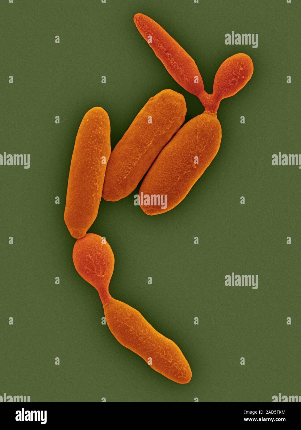 Coloured scanning electron micrograph (SEM) of Pseudozyma antarctica ...