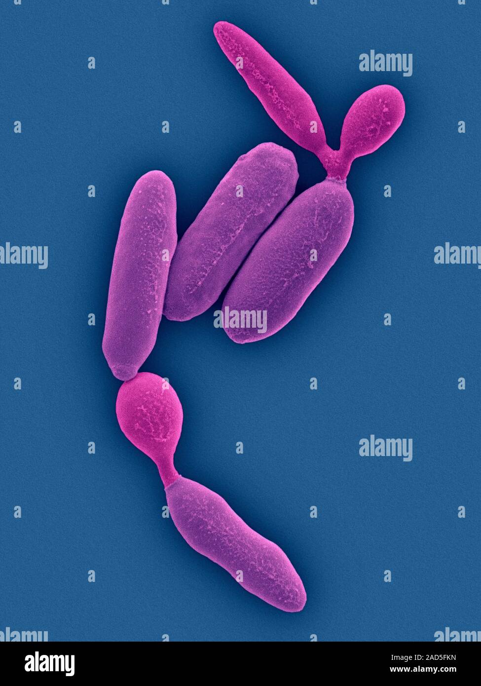 Coloured scanning electron micrograph (SEM) of Pseudozyma antarctica ...