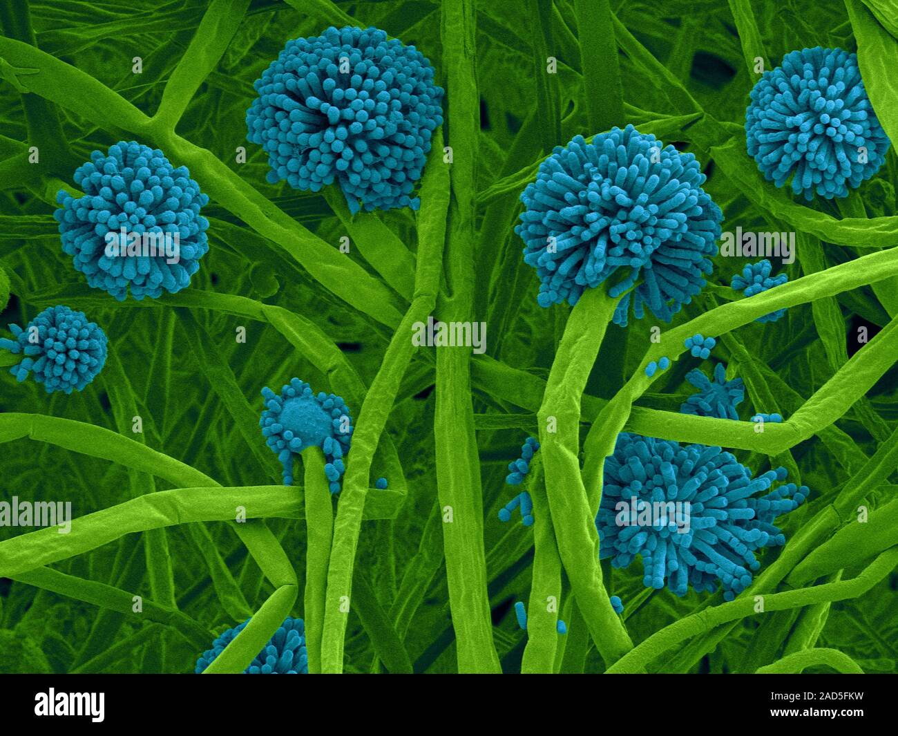 Coloured scanning electron micrograph (SEM) of Syncephalastrum ...