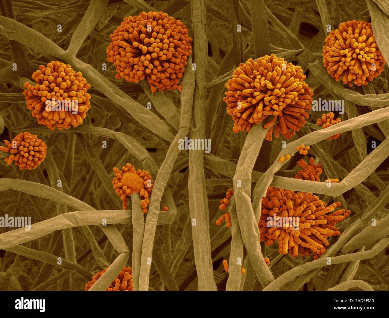 Coloured scanning electron micrograph (SEM) of Syncephalastrum ...
