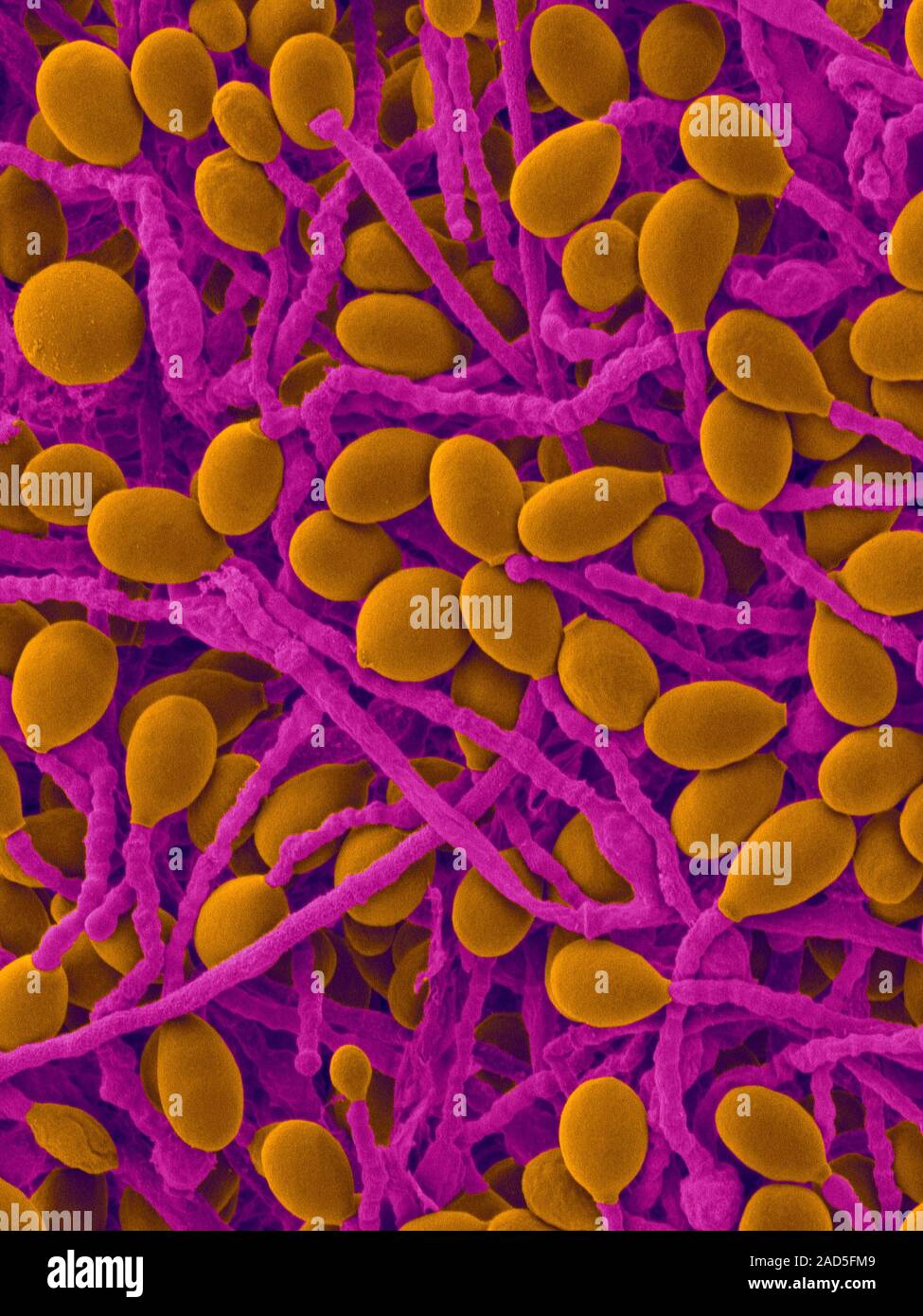 Coloured scanning electron micrograph (SEM) of Scedosporium prolificans ...