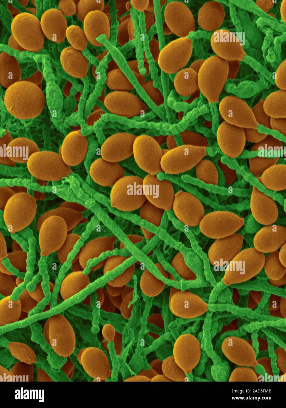 Coloured scanning electron micrograph (SEM) of Scedosporium prolificans ...