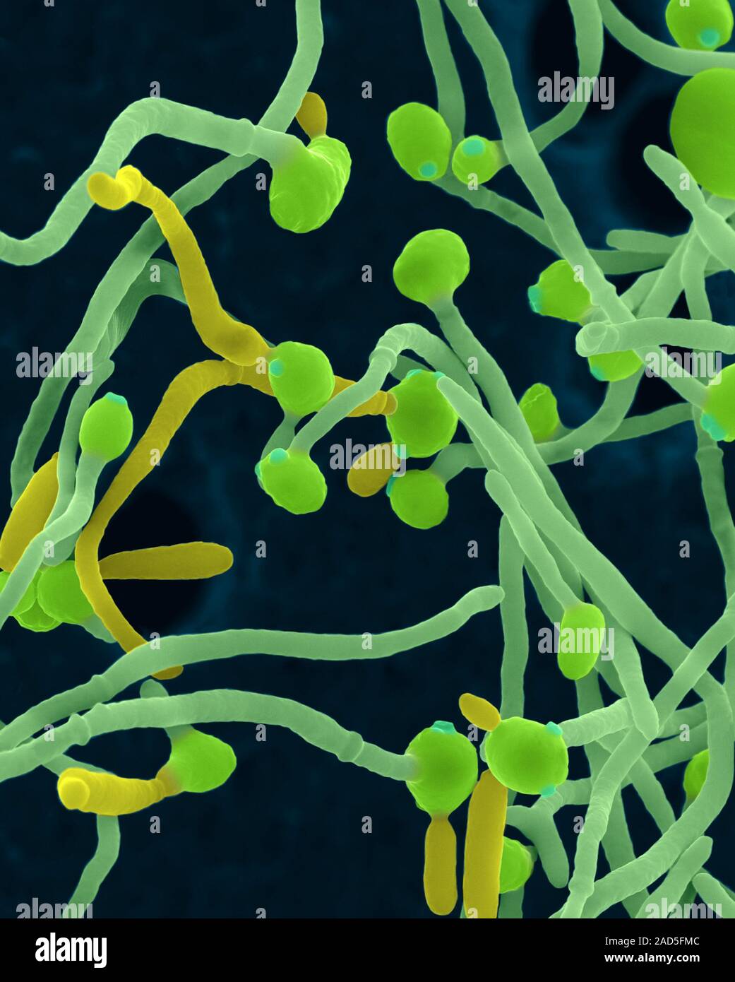 Coloured scanning electron micrograph (SEM) of Candida albicans - yeast ...