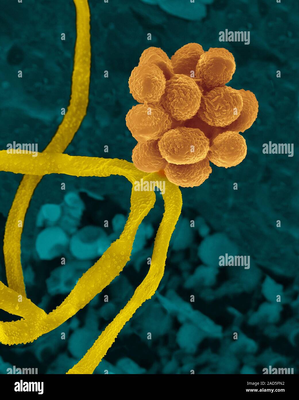 Coloured scanning electron micrograph (SEM) of Stachybotrys sp ...