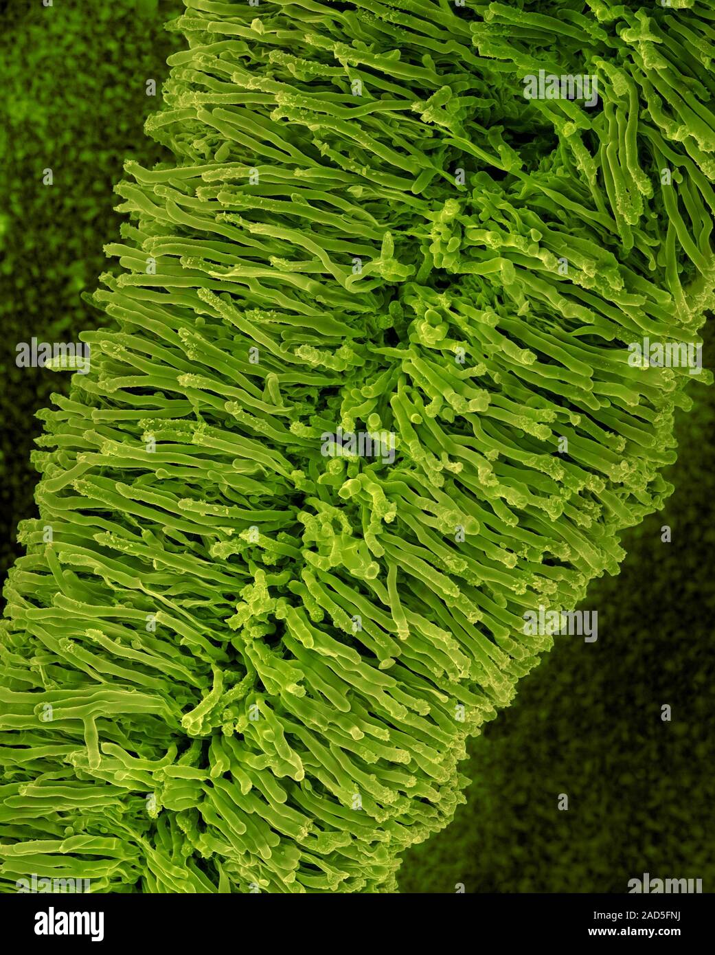 Coloured scanning electron micrograph (SEM) of the bracket fungus ...