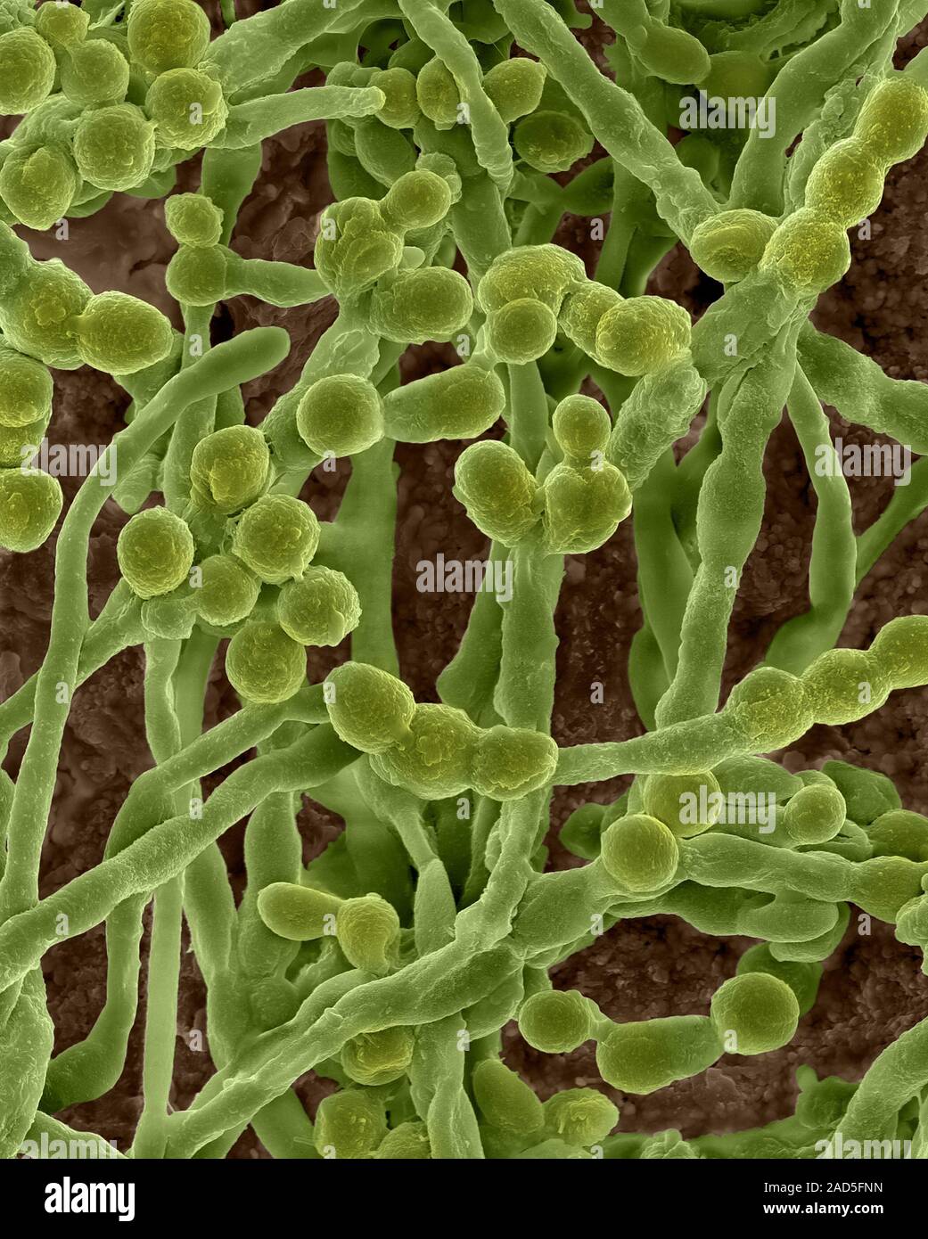 Coloured scanning electron micrograph (SEM) of the common environmental ...