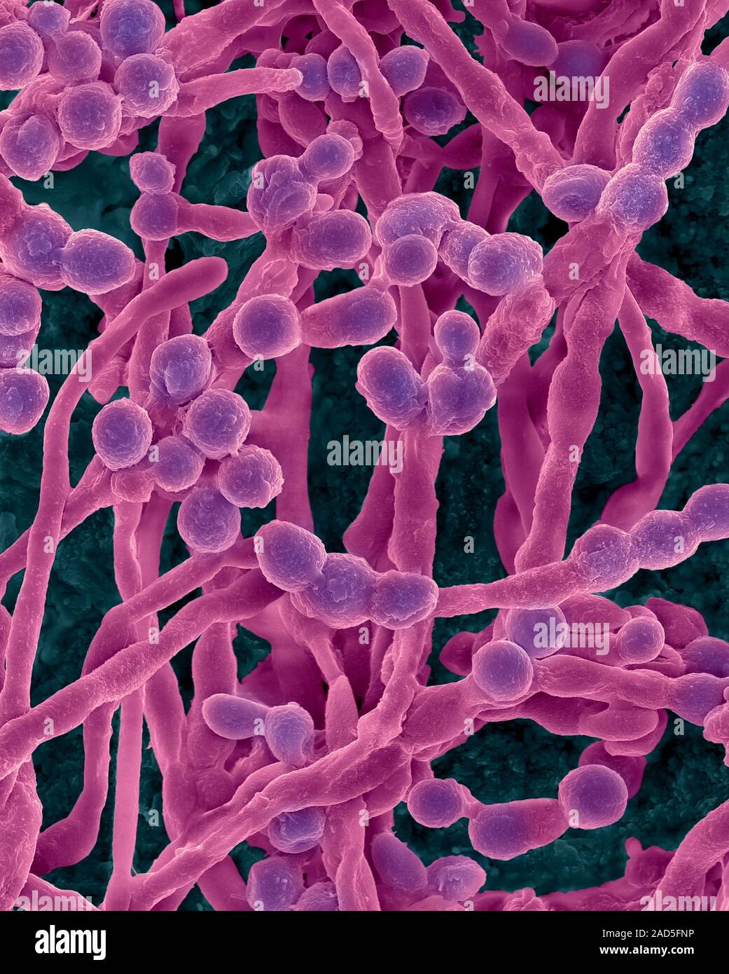 Coloured scanning electron micrograph (SEM) of the common environmental ...