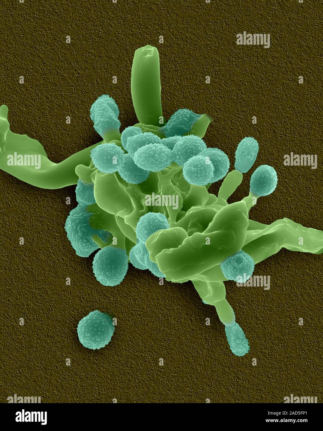 Coloured scanning electron micrograph (SEM) of Powdery mildew mould ...