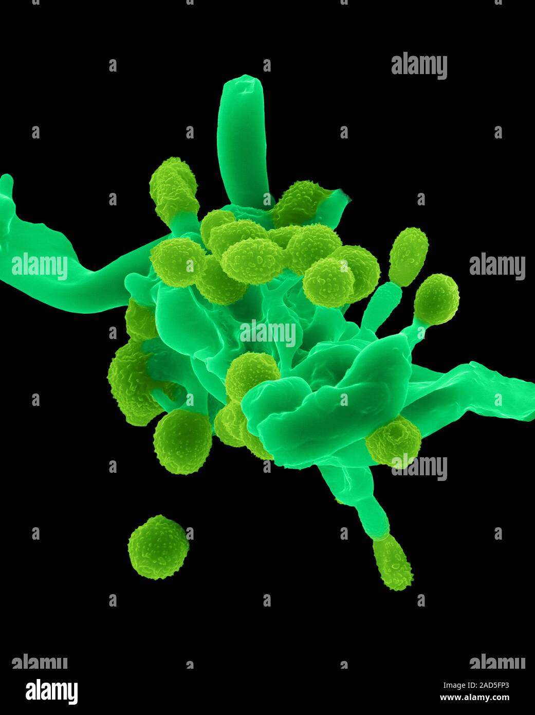 Coloured scanning electron micrograph (SEM) of Powdery mildew mould ...