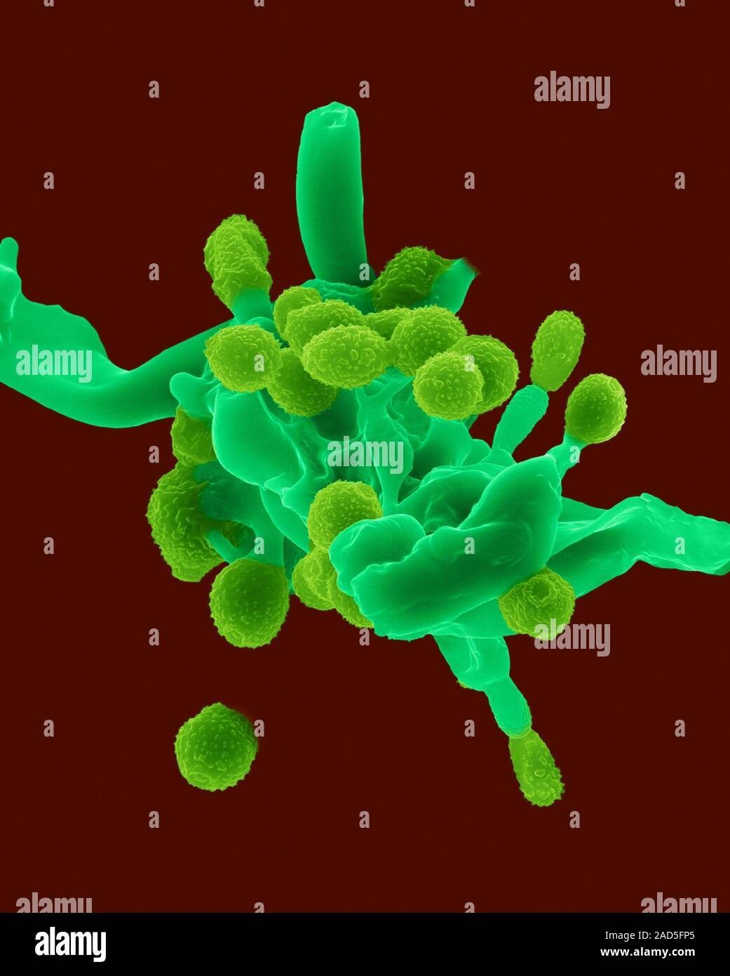 Coloured scanning electron micrograph (SEM) of Powdery mildew mould ...