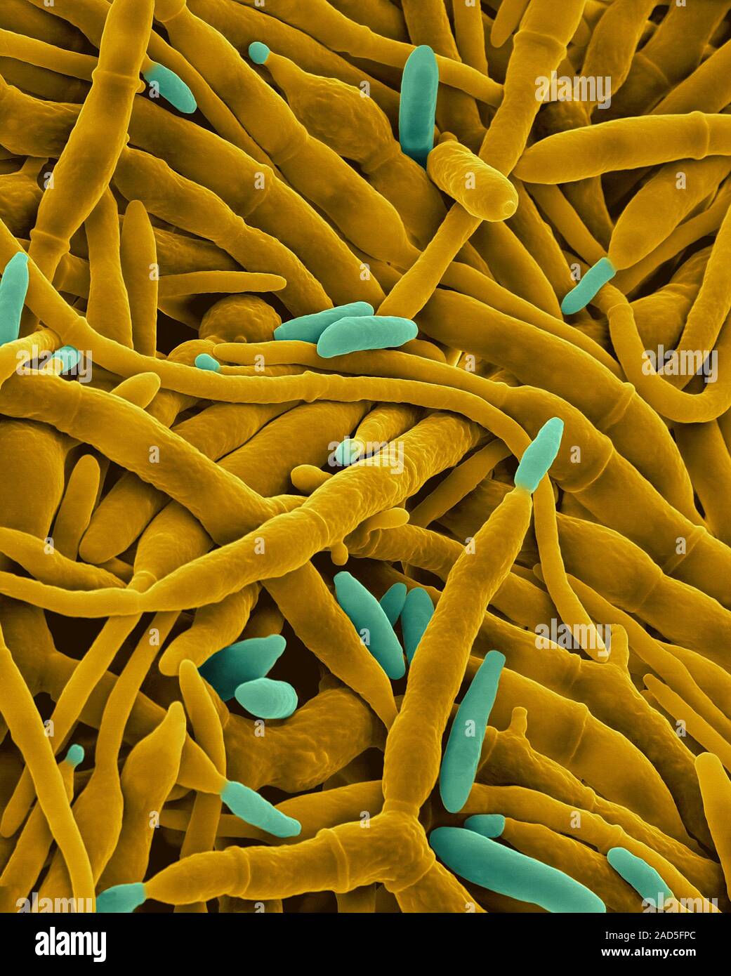 Coloured scanning electron micrograph (SEM) of Filamentous fungus ...