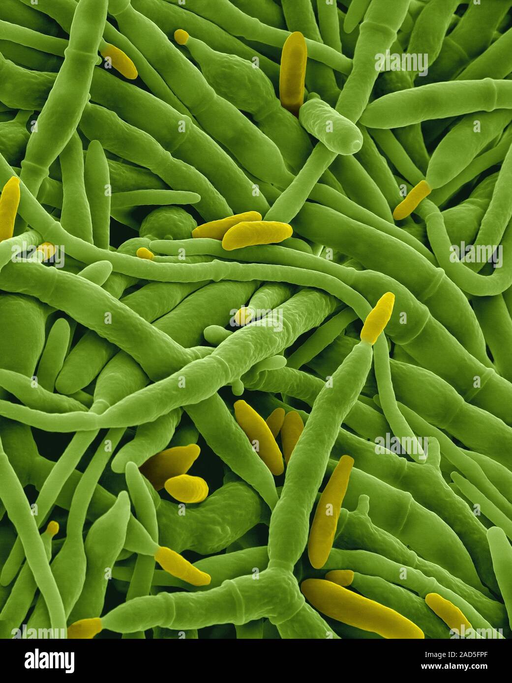 Coloured scanning electron micrograph (SEM) of Filamentous fungus ...