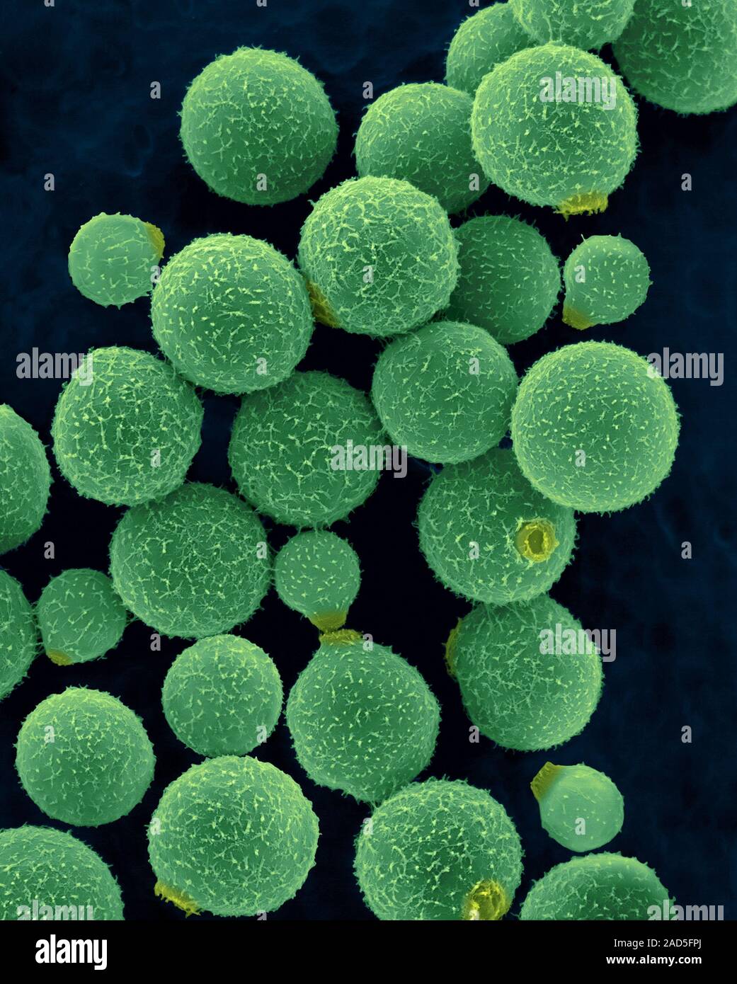 Coloured scanning electron micrograph (SEM) of Encapsulated pathogenic ...