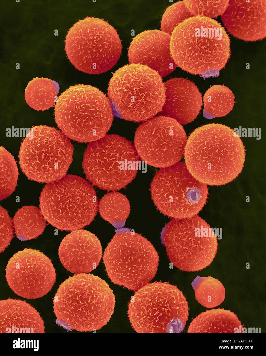 Coloured Scanning Electron Micrograph Sem Of Encapsulated Pathogenic Yeast Fungus