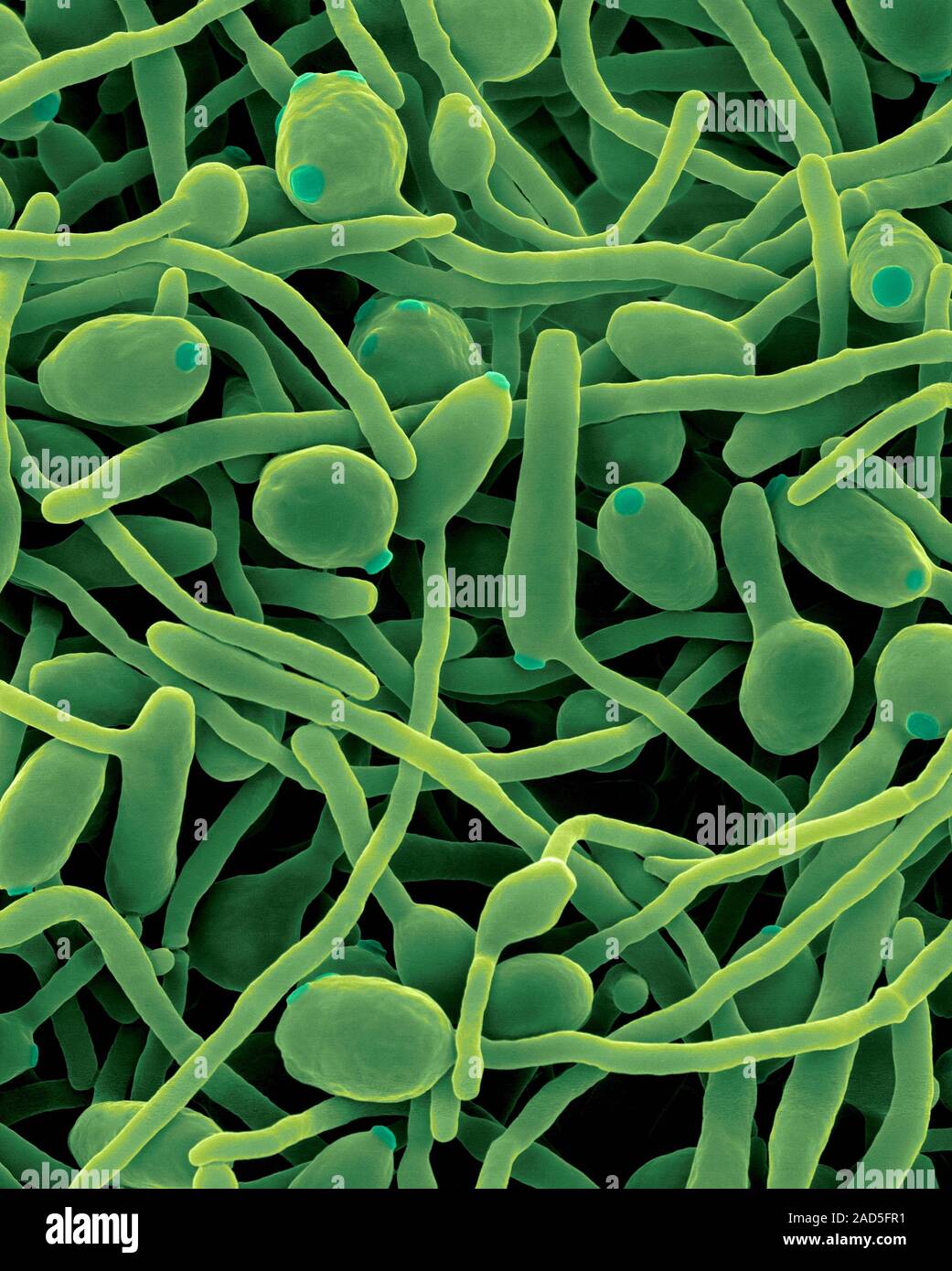 Coloured scanning electron micrograph (SEM) of Candida albicans - yeast ...